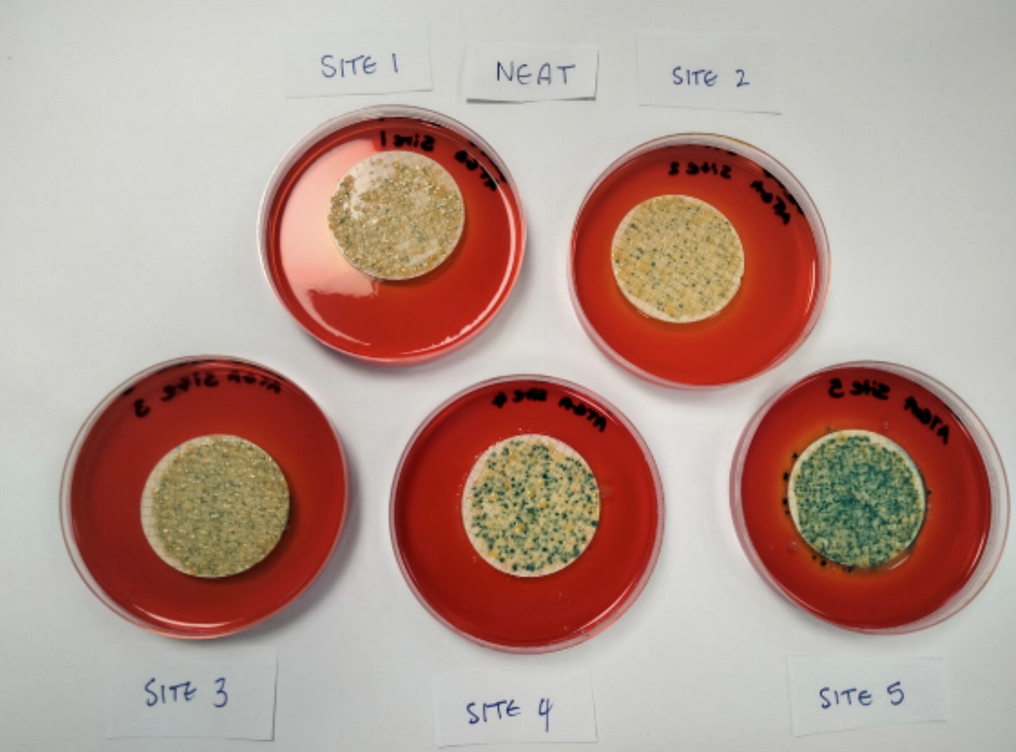 'Shocking' levels of potentially harmful bacteria found in River Frome ...